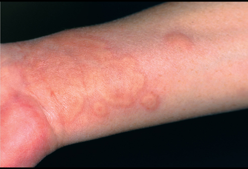 Study Medical Photos: Description Of Primary Skin Lesions