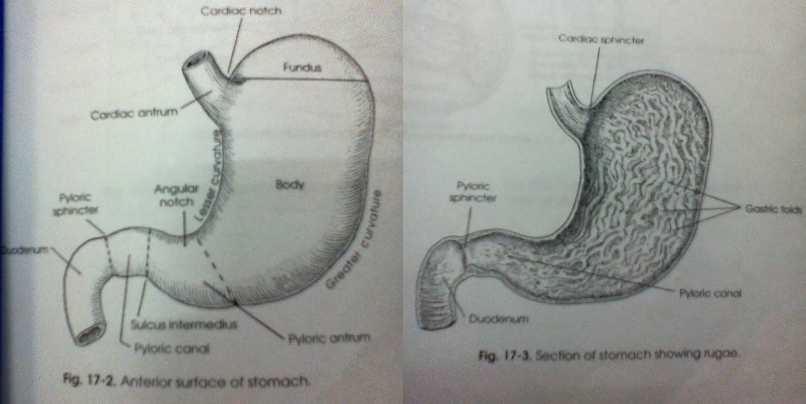 Radiologi: Teknik Pemeriksaan OMD (Oesofagus Maag Duodenum)