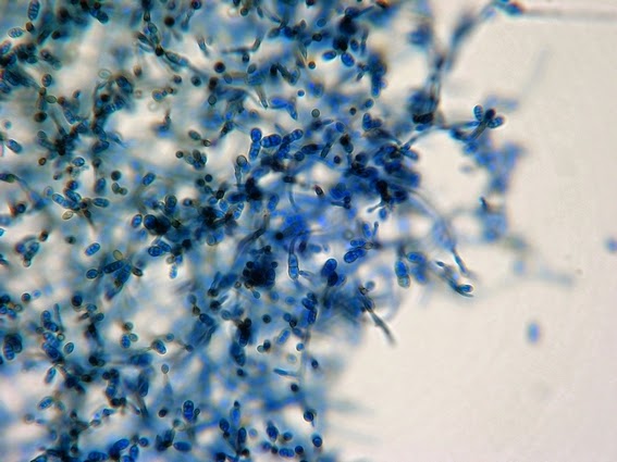 Fun With Microbiology (What's Buggin' You?): Ochroconis species