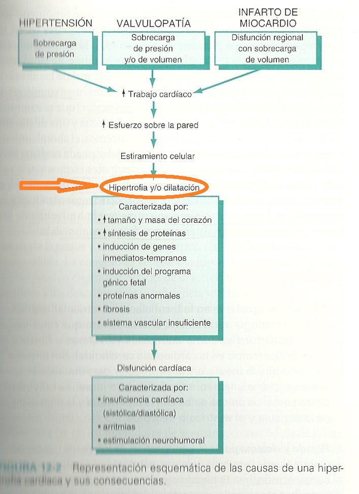 Patología B 2013: CARDIOPATIAS: INSUFICIENCIA CARDIACA CONGESTIVA Y ...