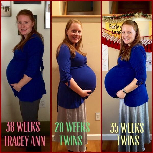 35 Weeks Pregnant With Twins
