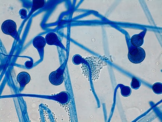 Fun With Microbiology (What's Buggin' You?): Absidia corymbifera ...