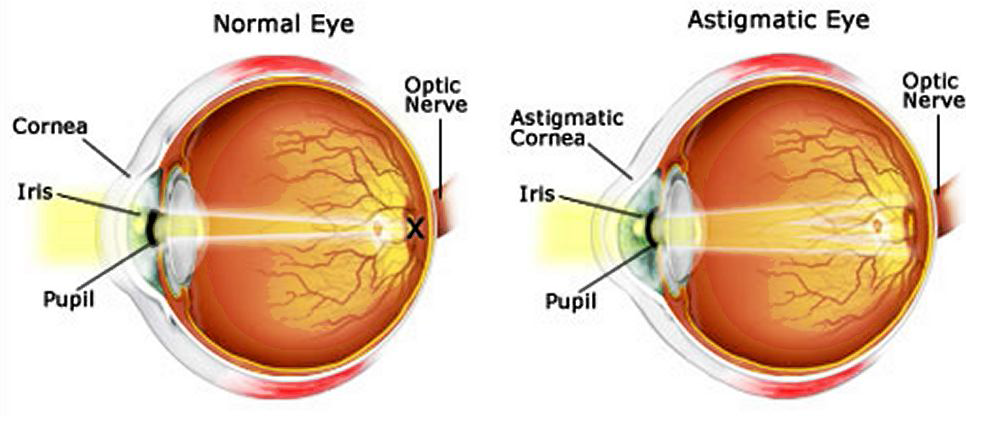 CBSE PHYSICS: X(10th) Human eyes and Colorful World