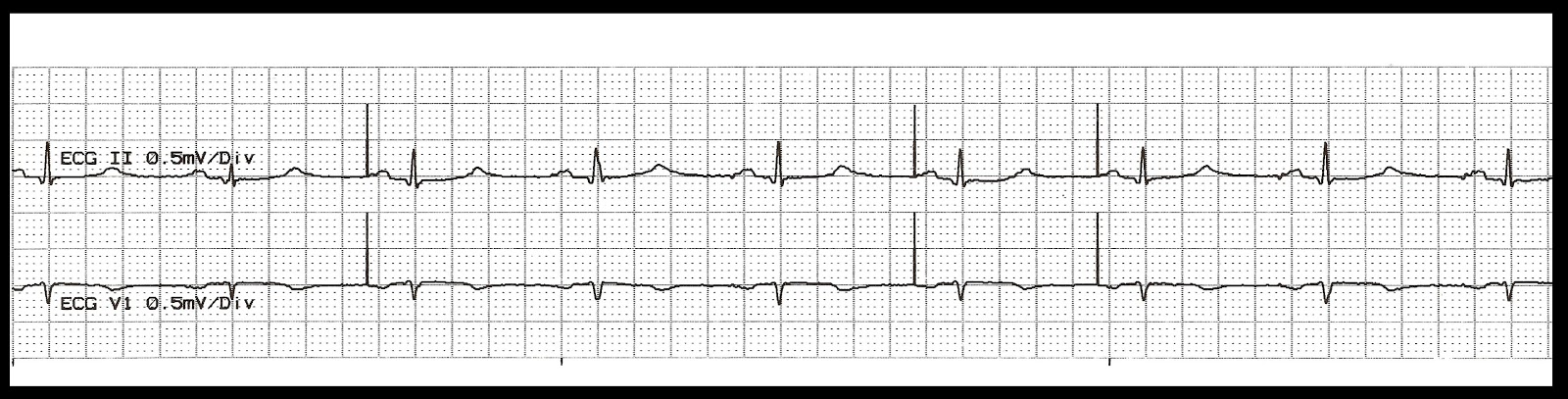 Practice EKG Strips