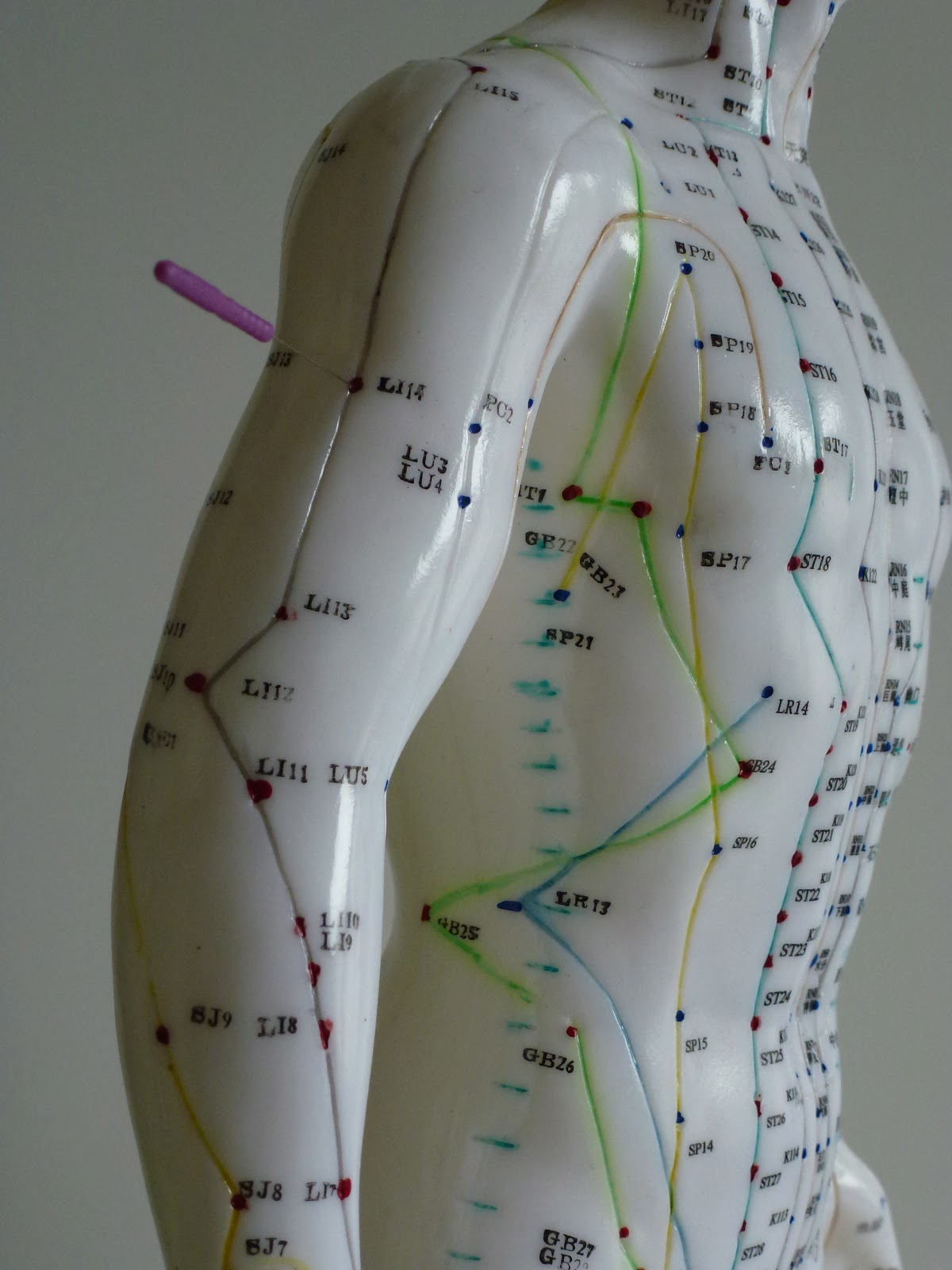 La consulta de las agujas