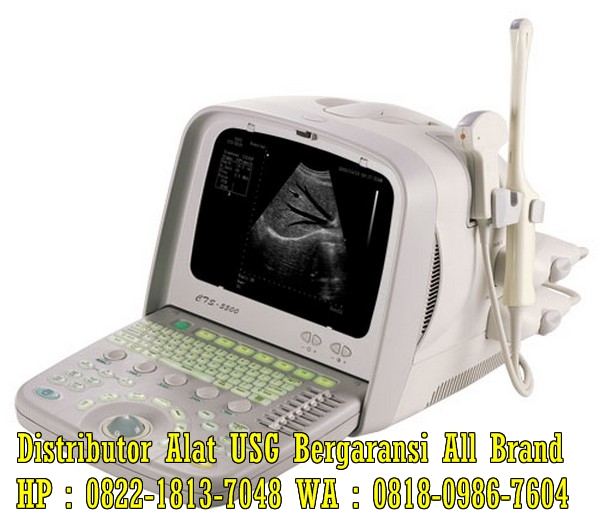 Science Archive: Alat USG doppler musculoskeletal