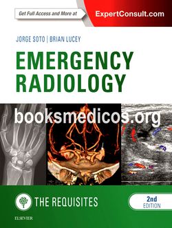 Emergency Radiology The Requisites 2nd Edition | booksmedicos