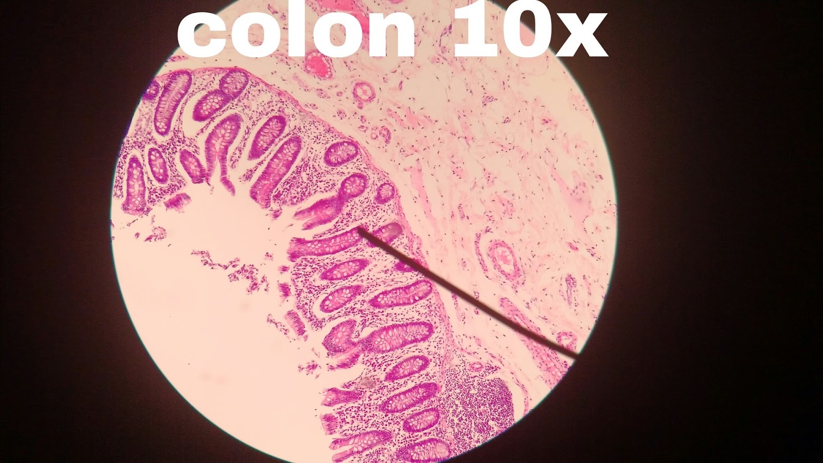THEONEDESTINY: Colon Histology