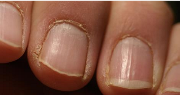 Expresiones De Amor Y Amistad: APRENDE A REMOVER LAS CUTÍCULAS