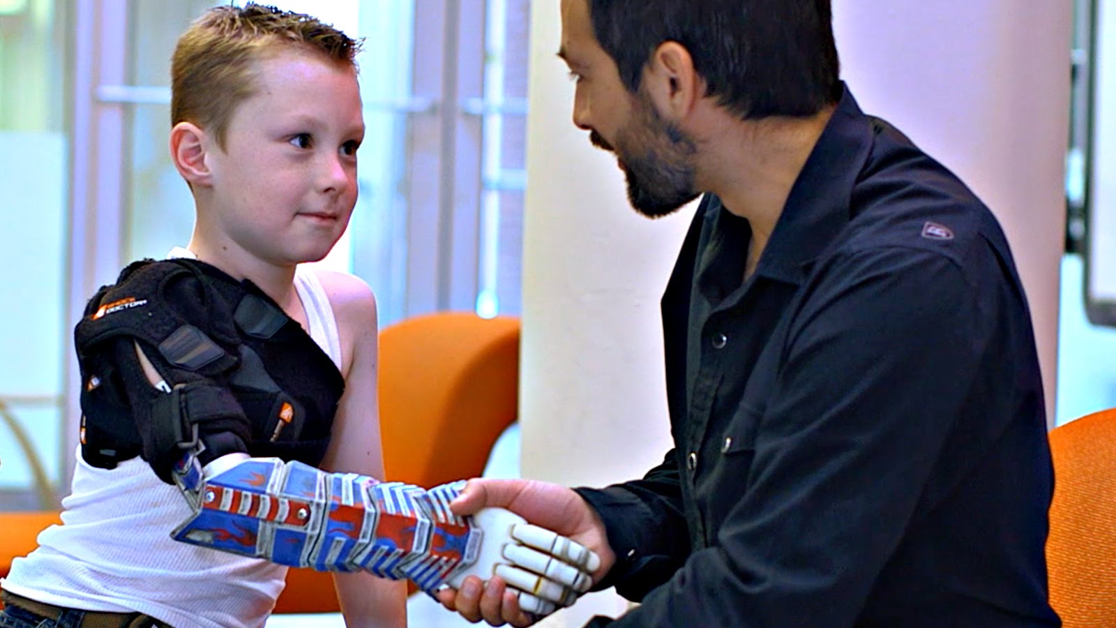 Artificial Limb Prosthetics : Overview, Procedure and Aftercare ...