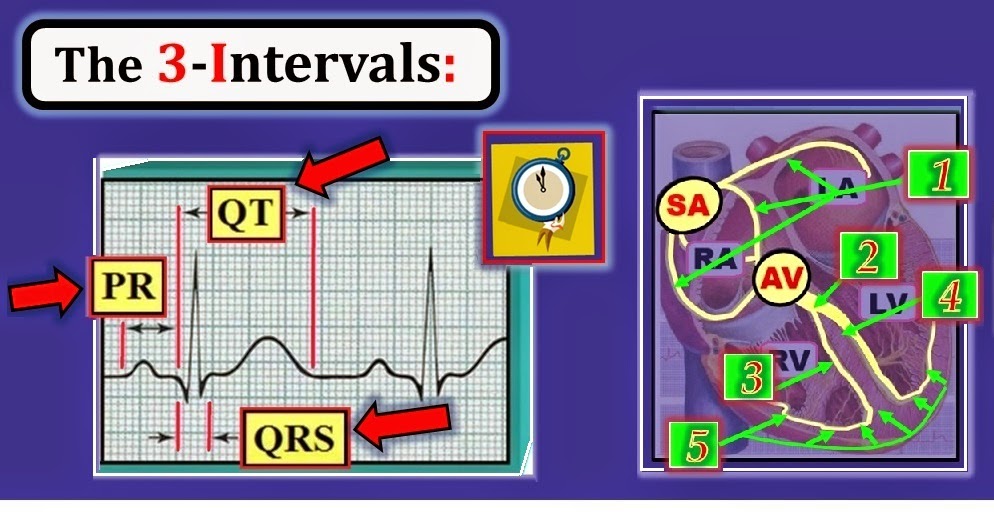 Intervals (PR - QRS - QT) : 네이버 블로그