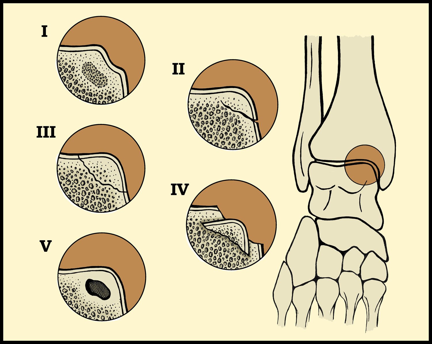 Tom Kbrink's Illustration and Design Blog: Medical Illustrations - the ...