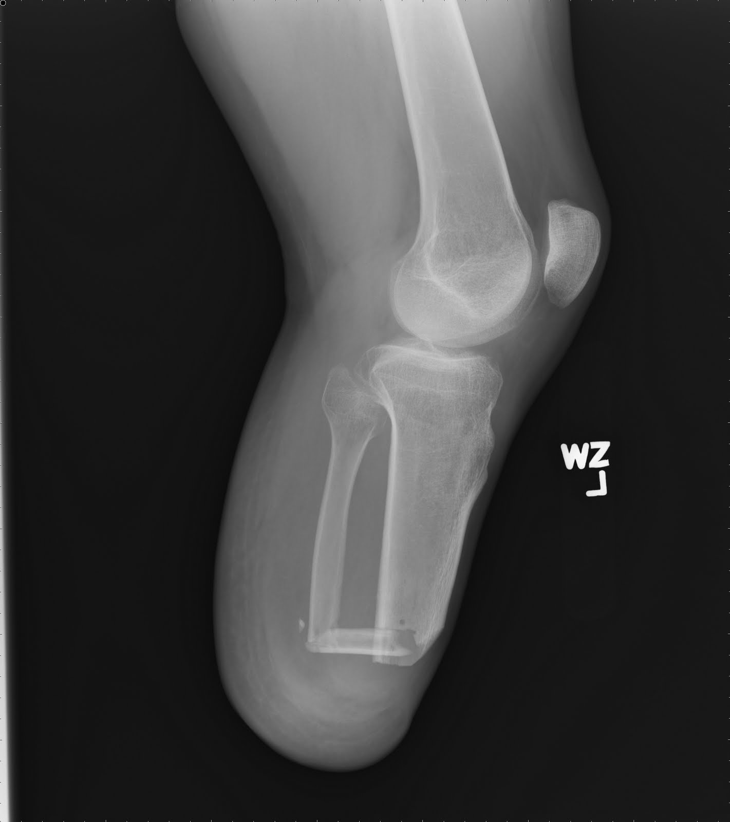 Bone Bridge to the Future: December 2011