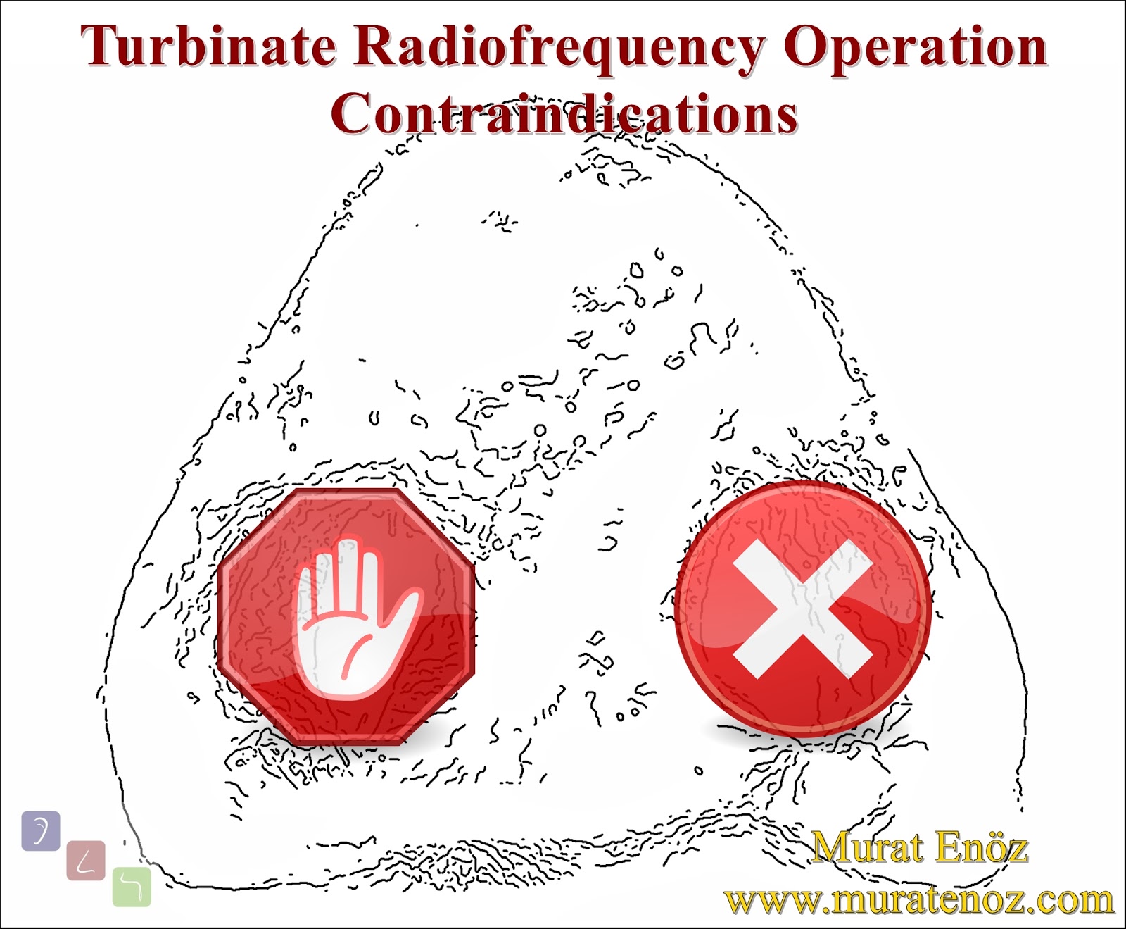 Radiofrequency Turbinate Reduction in Istanbul