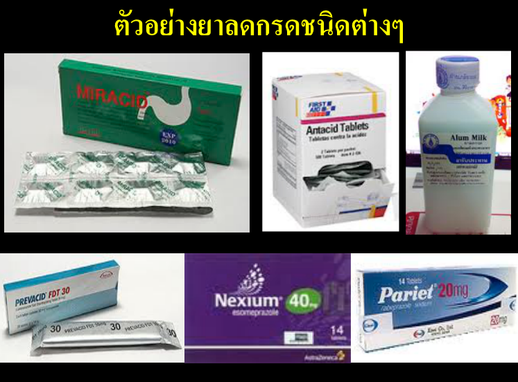 ยา miracid - Thai News Collections