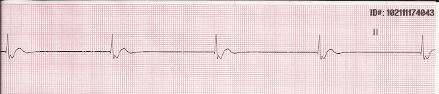 Pediatric Advance Life Support: Unstable Bradycardia