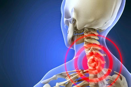 Diskus hernia: Diskus hernija vratni simptomi