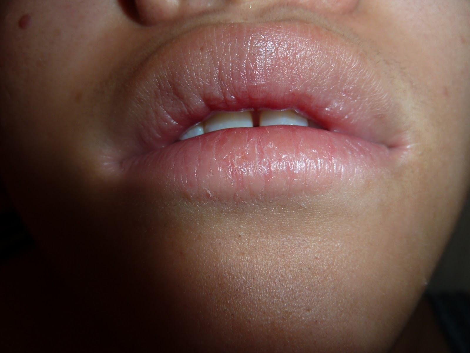 Solution to Chapped Lips | Zowie Power