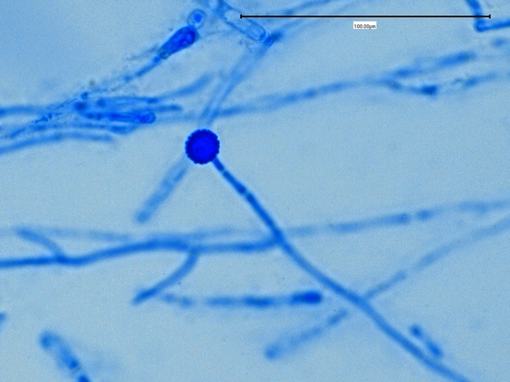 Fun With Microbiology (What's Buggin' You?): Sepedonium species