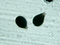 MICOLOGIA PANAMENSIS: Notas Micologicas (151). Observaciones sobre el ...