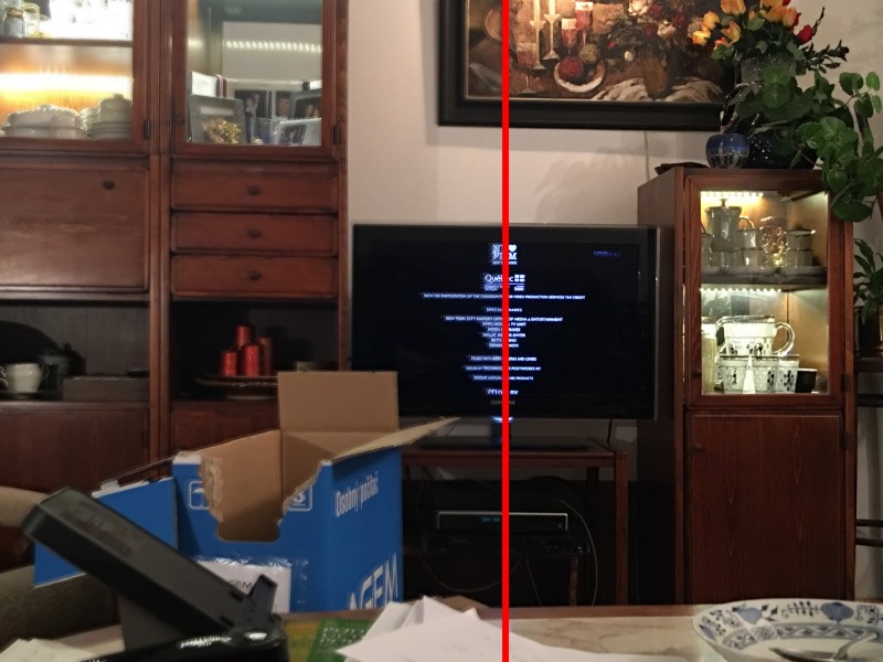 Visian ICL: experience with Visian ICL and Visian ICL surgery EVO, EVO+