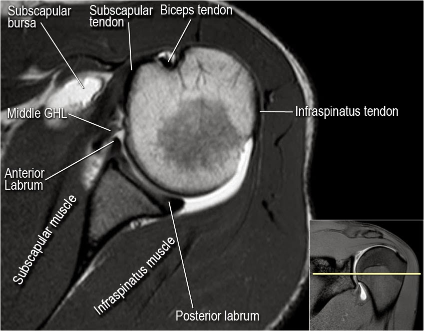 Radiology Anatomy Images : MRI Shoulder anatomy