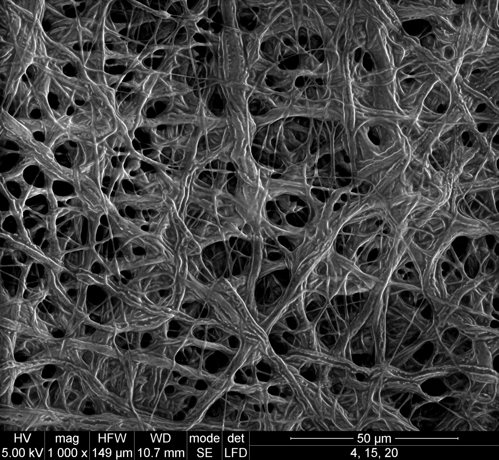 PhysioBLOGology: Electrospinning lecithin to prevent adhesions