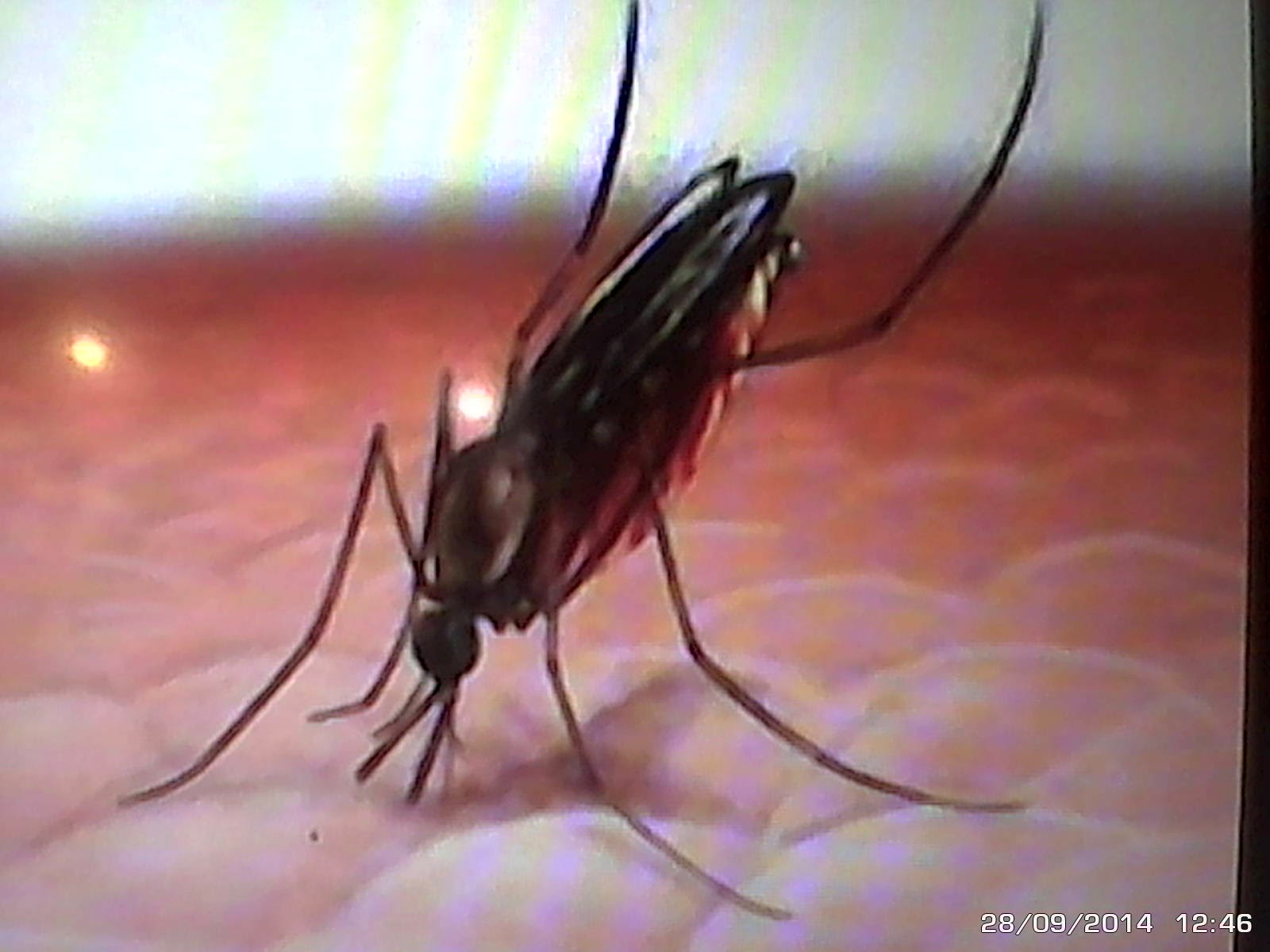 داء الفيلاريا| FILARIASIS ~ alarabestof