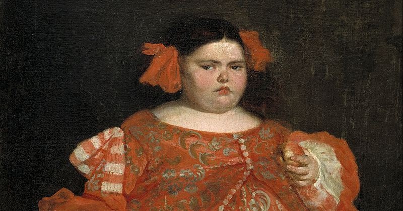 Un dermatólogo en el museo : La monstrua: ¿Hipercorticismo o síndrome ...