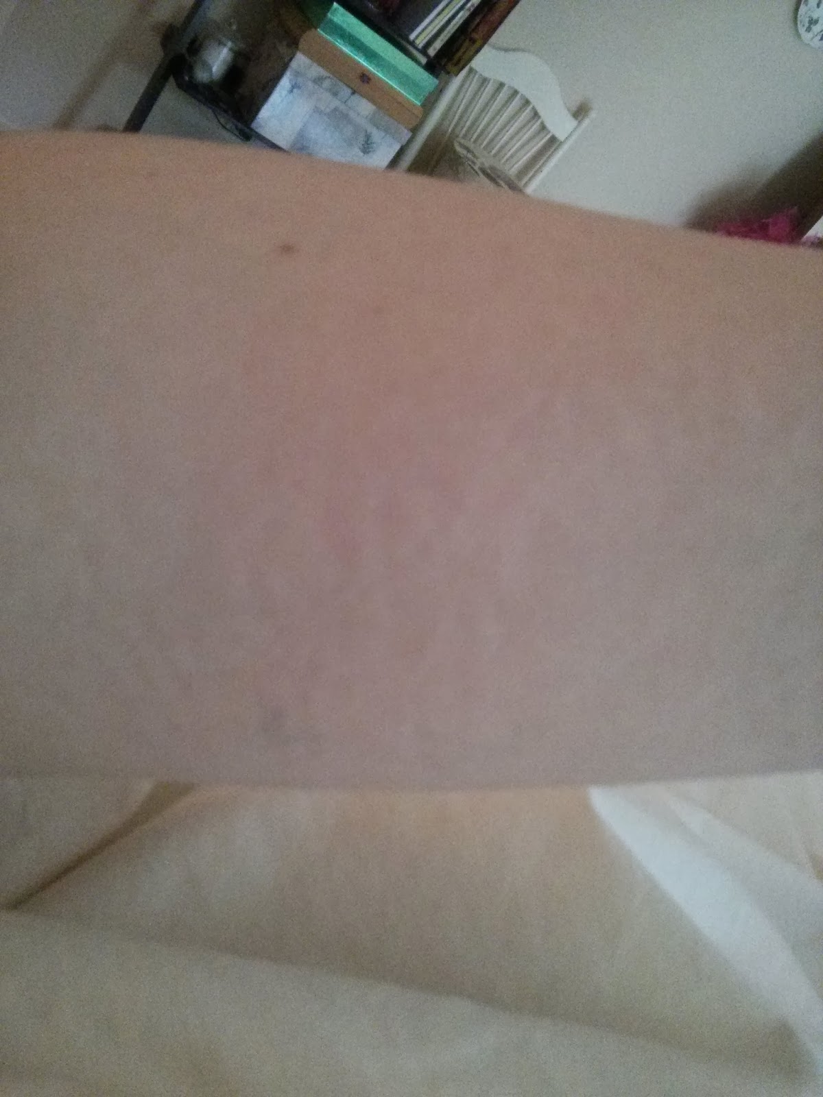 Living with Bob (Dysautonomia): That time I got waaaay too excited ...