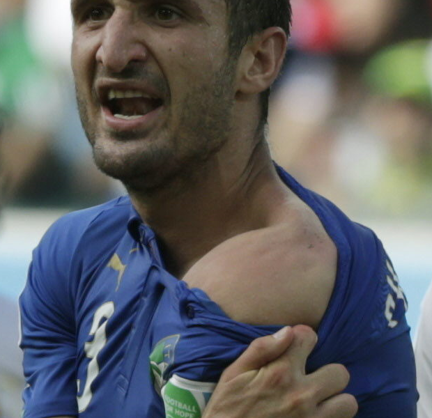 La ventana indiscreta de julia: El misterio de la mordida de Suárez a ...