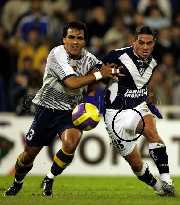 El bulto de los jugadores: El bulto de Lucas Castromán (2)