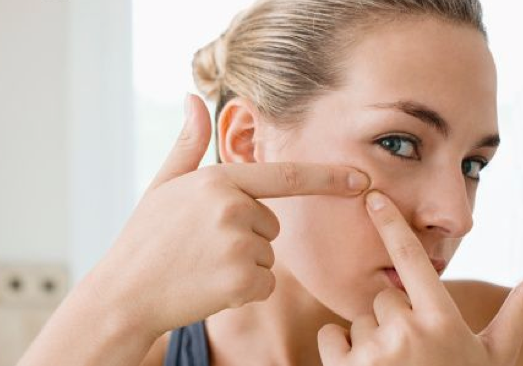 Liz Skincare Miami Wellness Beauty Lifestyle Blog : Skin Picking ...