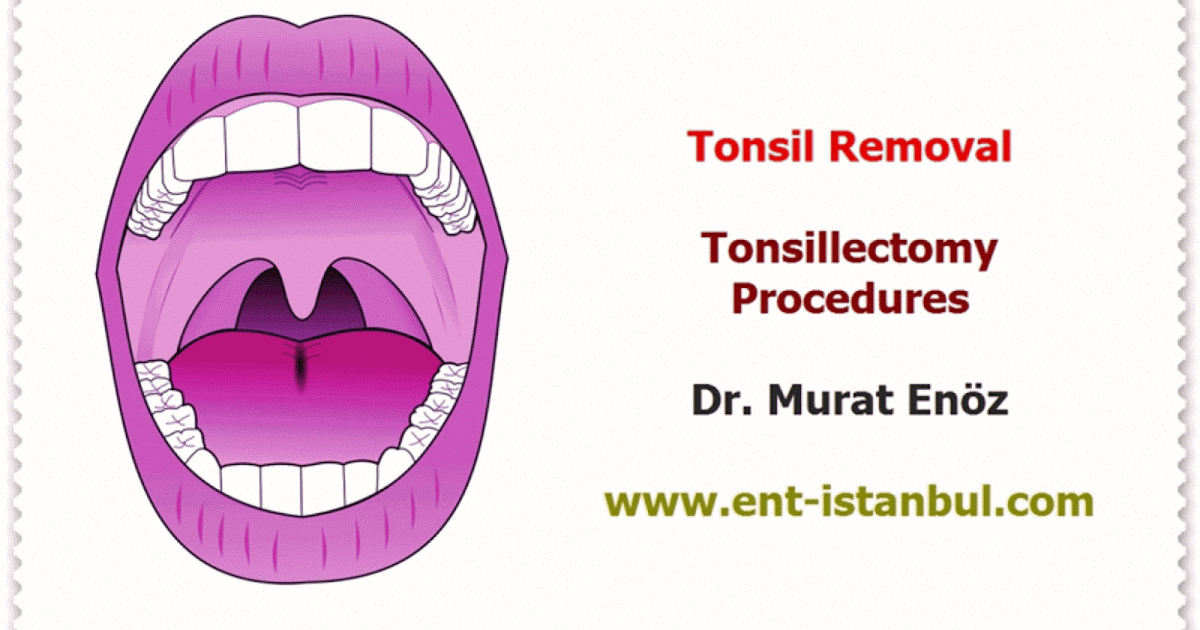 Tonsillectomy Operation in Istanbul