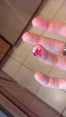 Traci Fruit: Mandolin Slicer Injury WARNING GRAPHIC!!