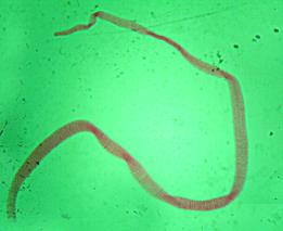 RIZNICA LEKOVITOG BILjA: PARAZITI U LjUDSKOM ORGANIZMU I KAKO SE IZLEČITI