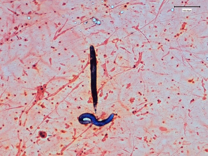 Fun With Microbiology (What's Buggin' You?): Strongyloides stercoralis ...