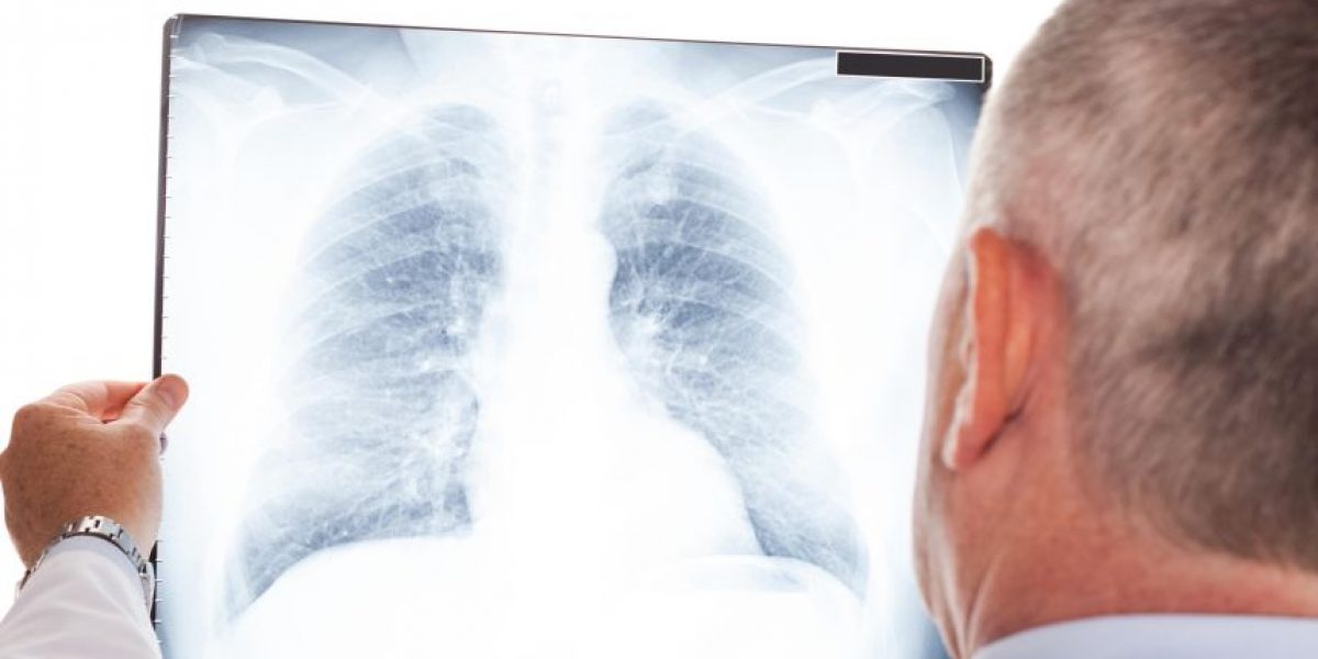 Sistema Experto Para El DiagnÓstico De Enfermedades Respiratorias En El