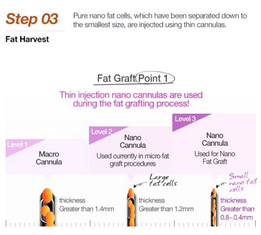 ID Hospital Korea: ID Hospital's NANO Fat Graft