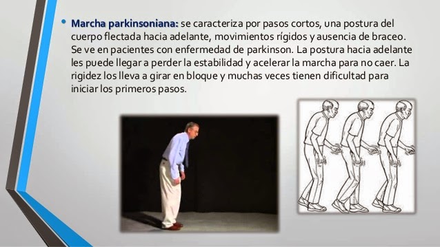 Tipos de Marchas Patológicas - Enfermagem em Ortopedia