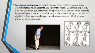 Tipos de Marchas Patológicas - Enfermagem em Ortopedia