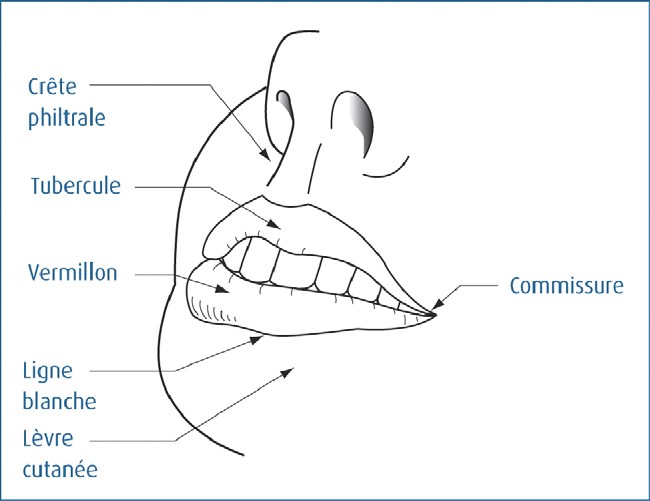 Carcinomes des lèvres | faerweel