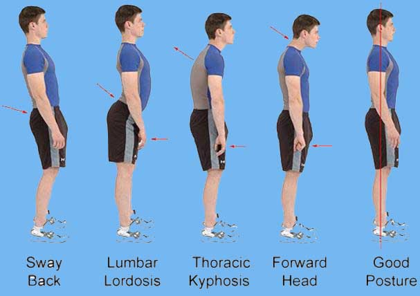 Activities to Straighten Out the Spine | HOW CAN DONE
