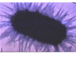 simple techno: IDENTIFIKASI KUMAN PROTEUS