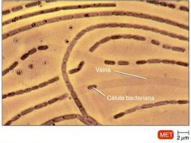 MicroBichos: Sphaerotilus natans, un microorganismo asociado a ...