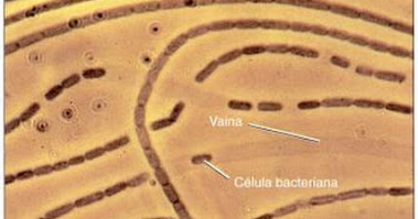 MicroBichos: Sphaerotilus natans, un microorganismo asociado a ...