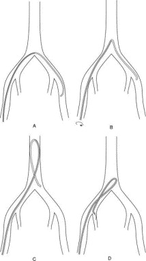 The Pump and the Tubes: The Uterine Artery