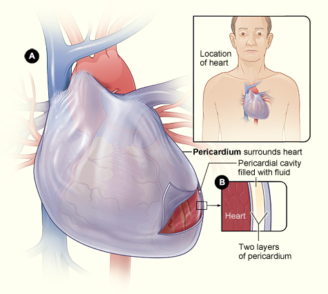An Unexpected Error: Living without a Pericardium