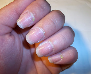 Not Too Polished: Officially In Rehab