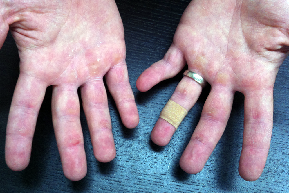 FITBOMB: CrossFit Hand Care